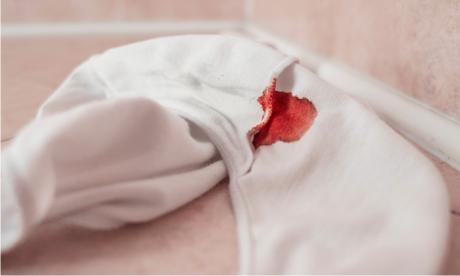 How To Remove Period Stains Easily | 5 Top Tips | fluxies